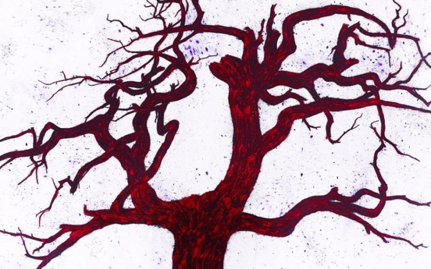 Tony Bevan at Ben Brown Fine Arts: The tree of life, death and the mind